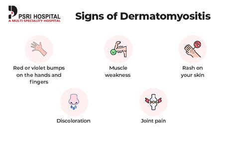 What Is Dermatomyositis Symptoms Causes And Therapies