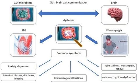 Fibromyalgia And Irritable Bowel Syndrome Interaction A Possible Role For Gut Microbiota And