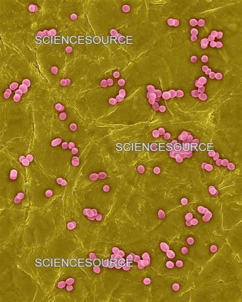 Enterococcus Faecium On Human Skin Sc Stock Image Science Source Images