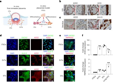 Sars Cov 2 感染的胎盘模型揭示了合体滋养层中 Ace2 依赖性的易感性和分化障碍 Nature Cell Biology X Mol