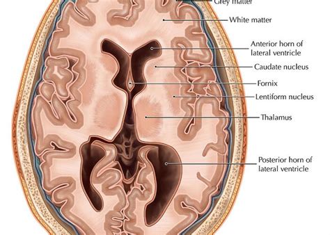Lentiform Nucleus Art Fine Art America