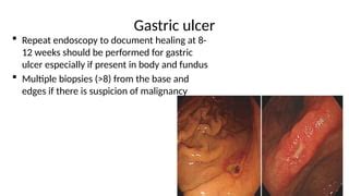 5 Endoscopy 2 Pptxppt On Edoscopy Techniques Pptx