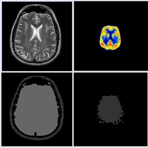 Region Mapping A Spatial Transformation Modifies The Spatial Download Scientific Diagram