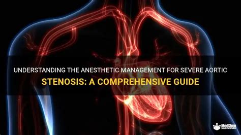 Understanding The Anesthetic Management For Severe Aortic Stenosis A Comprehensive Guide Medshun