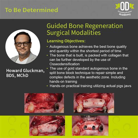 Guided Bone Regeneration Surgical Modalities Osseodensification Academy