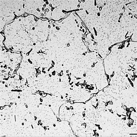 Optical Micrographs Which Illustrate A Typical Dendrite Structure Of
