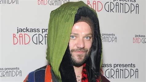 Jackass Star Bam Margera Says He Was Pronounced Dead After