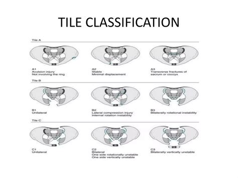 Pelvic Fractures Pptx
