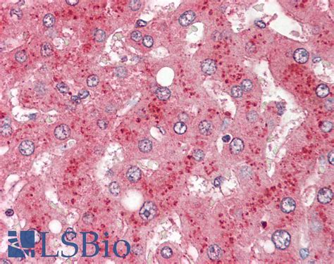 Ihc Plus™ Cfb Complement Factor B Polyclonal Antibody Goat Lsbio