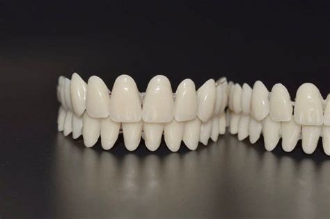 Upper Partial Dentures