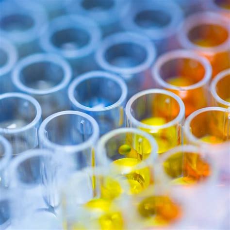 Network Audit An Overview