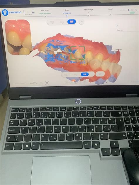 Stomatoloska Ordinacija Dr Simonovic Bar