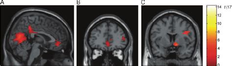 Significant Correlations With Rpe Equation 12 At Time Of Feedback