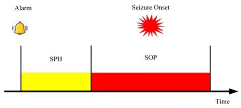 Brain Sciences Free Full Text Eeg Based Seizure Prediction Using Hybrid Densenetvit Network