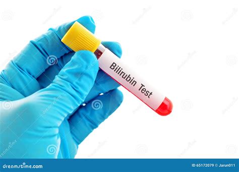 Bilirubin Test Stock Image Image Of Medicine Laboratory 65172079