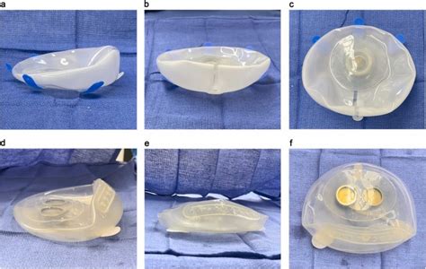 Dual Port And Single Port Tissue Expanders In Postmastectomy Breast