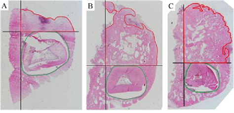 Histologic Slide Describing The Histomorphometric Analysis Two