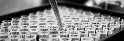 Predicting Systemic Lupus Erythematosus Using A Clinical Algorithm Model And Cell Dna Lupus