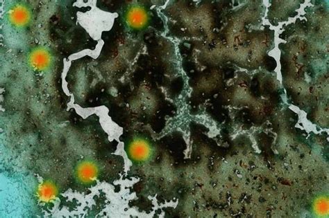 Ai Can Spot Parasites In Stool Samples To Help Diagnose Infections