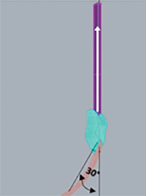 What Is Traction Force In Physics At Gabriel Basser Blog