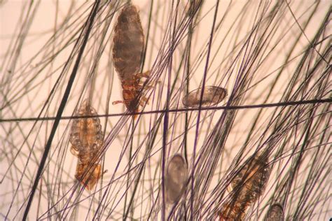 All About Cat Lice Great Pet Care