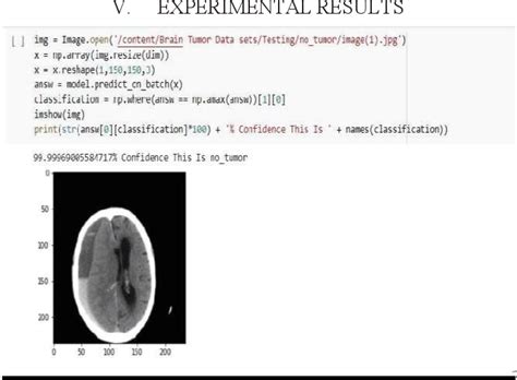 Figure 3 From Comprehensive Analysis Based On One Hot Encoder For Brain