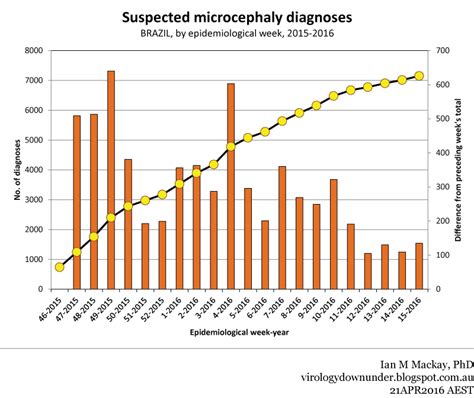 Microcephaly Chart A Visual Reference Of Charts Chart Master