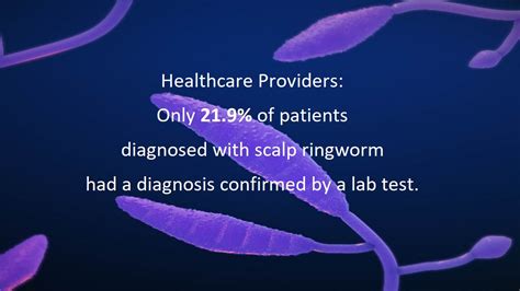 Antifungal Medication Tinea Capitis At Darlene Watson Blog