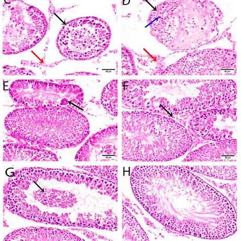 Testicular Sections From All Experimental Groups Were Stained With