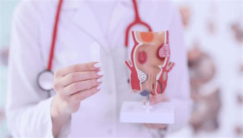 What Do Hemorrhoids Look Like Leicester Bowel Clinic