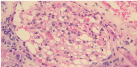 Case 2 Light Microscopy Glomerulus Download Scientific Diagram