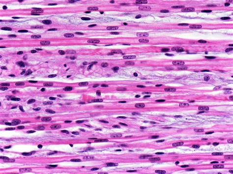 Fetal Skeletal Muscle 2 By Science Photo Library