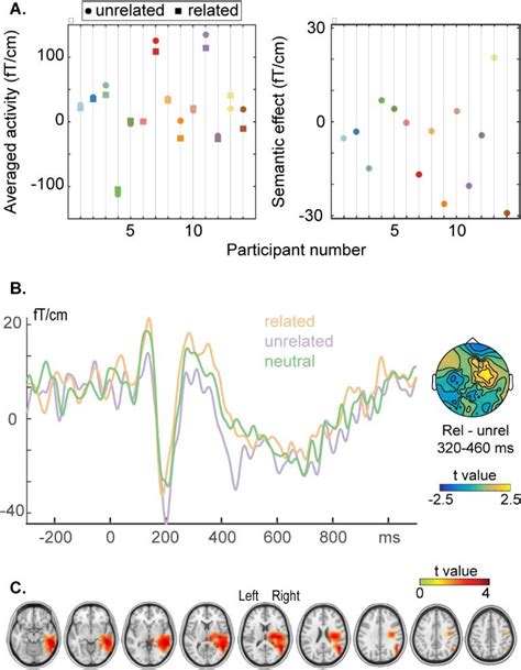 A Meg Results Averaged Activity Between 350 450 Ms Over Left Download Scientific Diagram