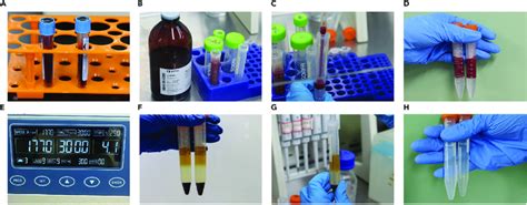 Isolation Of Human Peripheral Blood Mononuclear Cells Pbmcs A