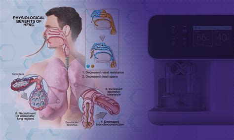 High Flow Nasal Cannula Biosys