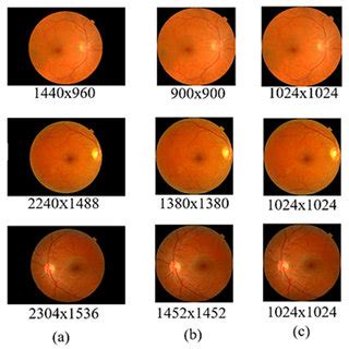 PDF Analysis Of Medical Image Resizing Using Bicubic Interpolation Algorithm