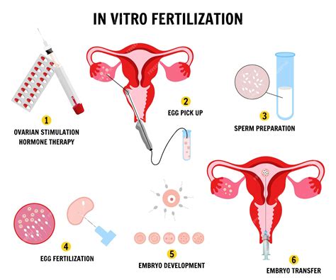 Premium Vector In Vitro Fertilization Composition With Sperm Preparation In Vector