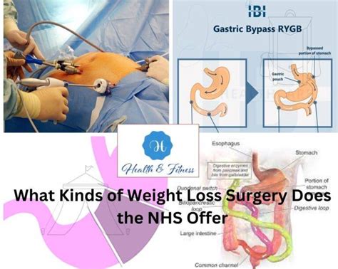Weight Loss Surgery Nhs What You Need To Know