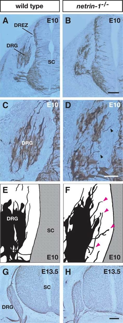 Defects In Axonal Trajectories At Initial Stages Of Drg Axonal
