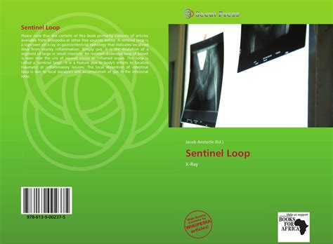 Sentinel Loop 978 613 9 00237 5 6139002370 9786139002375