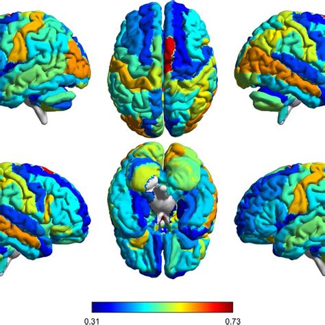Visualization Of Contribution Level Of Each Brain Region In The Sz