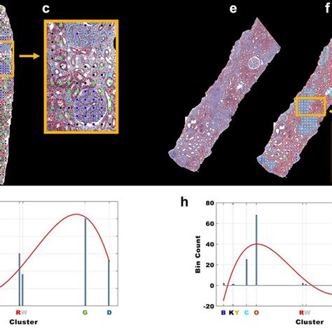 Two Examples Of Biopsy Samples Ae Two Examples Of Biopsy Samples