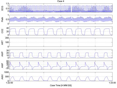 case 4 waveform plots 60 second plots