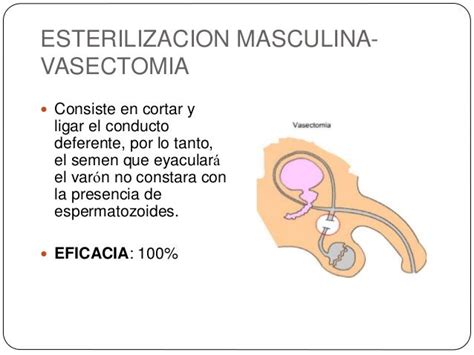Anticonceptivos