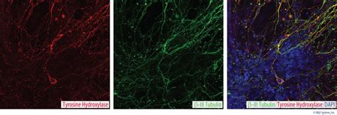 Dopaminergic Neuron Differentiation Kit Sc001b Randd Systems