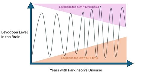 Dyskinesia And Parkinsons Disease — Wpc Blog