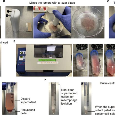 Digest The Tumors With Collagenasehyaluronidase Dissociation Buffer