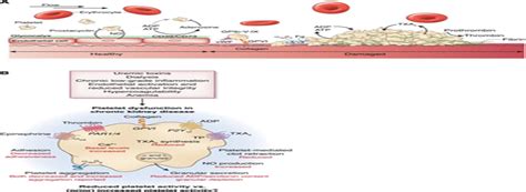 Platelet Abnormalities In Ckd And Their Implications For Ant Clinical Journal Of The