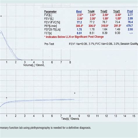 Spirometry Results Showing Obstruction Download Scientific Diagram