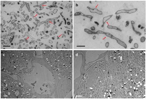 Monitoring The Colonization And Infection Of Legume Nodules By